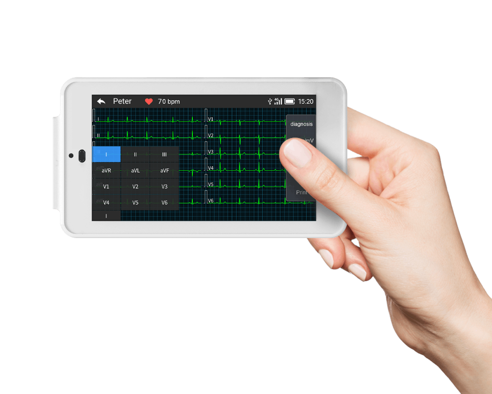 Mobile 6/12-Lead EKG/ECG Machine Fits into Your Pocket, with Auto Interpretation, Wirelessly ...